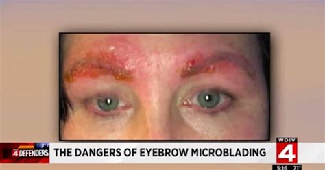 Womans Horrific Microblading Experience Led To A Costly Infection