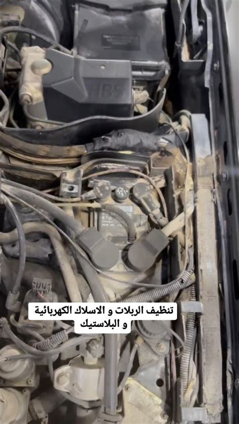 ‎dryice ️ Carbon⚡️laser 🇰🇼 دراي آيس كاربن ليزر‎ Dryicecarbonlaser