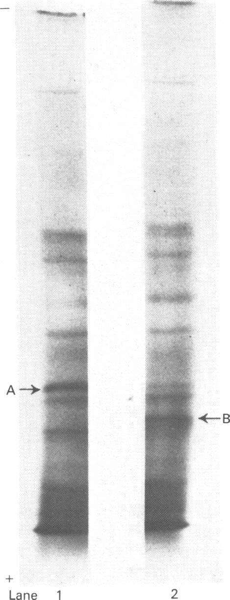 Sdspolyacrylamide Gel Electrophoresis On A 15 Slab Gel Of