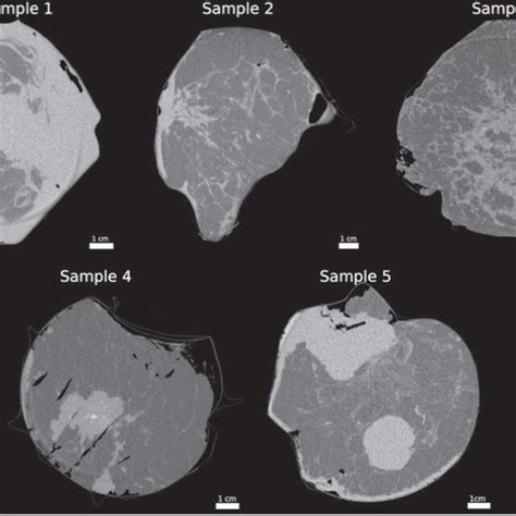 Theoretical Data Points Fitted To A A Linear Calibration Curve For