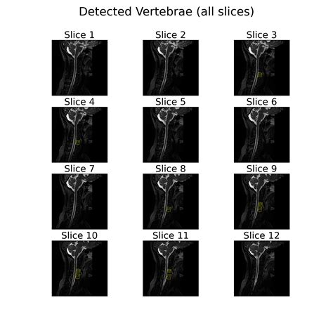 Experiencing Issues With Data From The Spinegeneric Dataset Issue