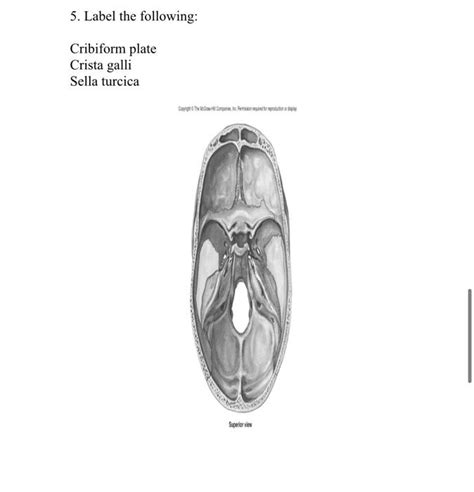 Solved 5 Label The Following Cribiform Plate Crista Galli