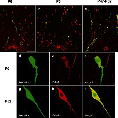 Gonadotropin Releasing Hormone Immunofluorescence If Gnrh And