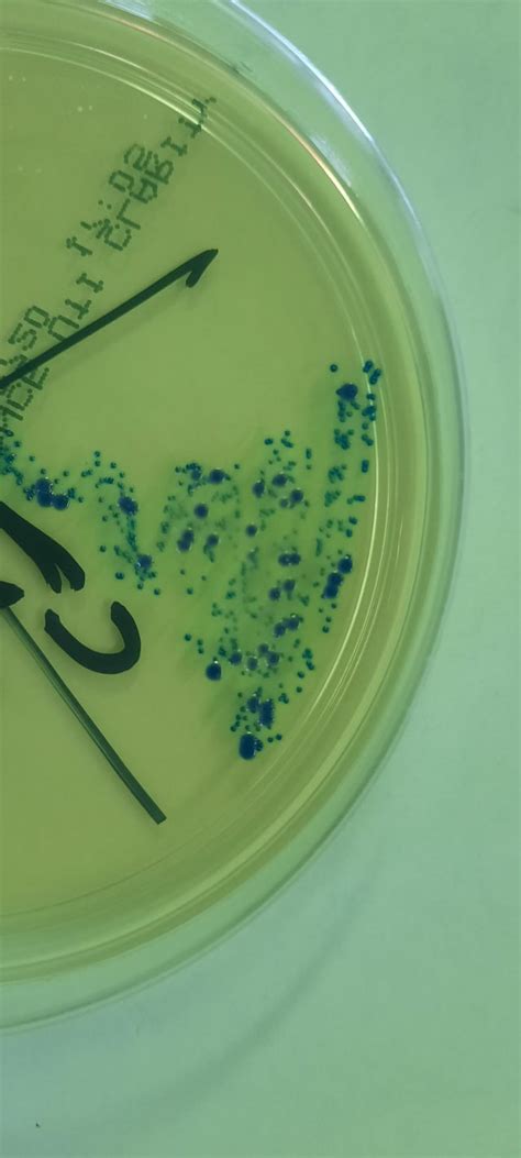Enterobacter Aerogenes Found In Cervical Sample Rmicrobiologyobsession