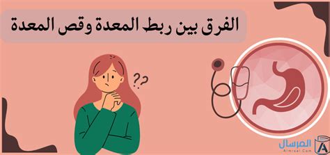ربط المعدة وقص المعدة الفرق بينها بالتفصيل المرسال