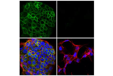 Integrin β6 E4m9p Xp® Rabbit Mab Bsa And Azide Free Cell