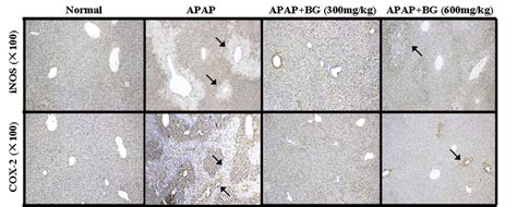 Effects Of Bg On Expression Of Cox 2 And Inos In Liver Tissues Arrows