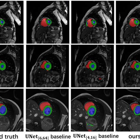 Visualization Of Results By Different Methods Download Scientific