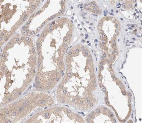 Phospho Smad3 Ser425 Antibody Pa5 104939