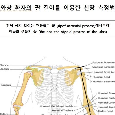 와상 환자의 팔 길이를 이용한 신장 측정법 MEDIARABA