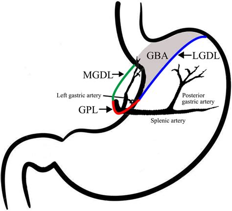 Illustration Of Gba Mgdl Lgdl And Gpl Download Scientific Diagram