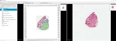 Qupath Point Aligment Image Analysis Image Sc Forum