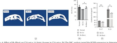 Pdf Rhoa Promotes Synovial Proliferation And Bone Erosion In