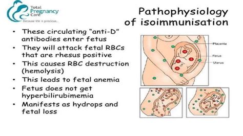 Rh Incompatibility Ppt