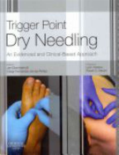 Trigger Point Dry Needling 9780702046018 Dommerholt Jan Malé Centrum