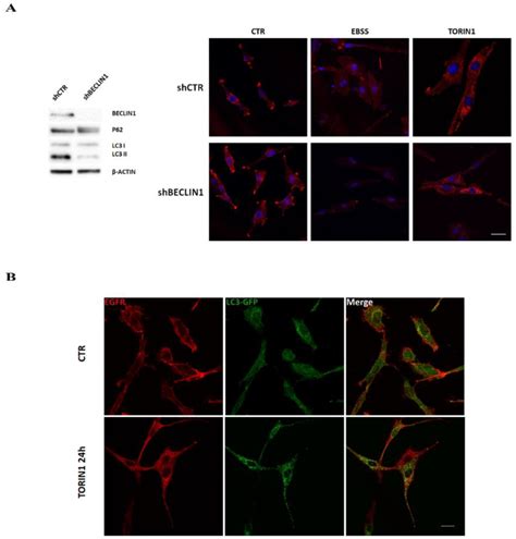 Egfr De Localisation In Gbm Cells Is Independent Of Canonical