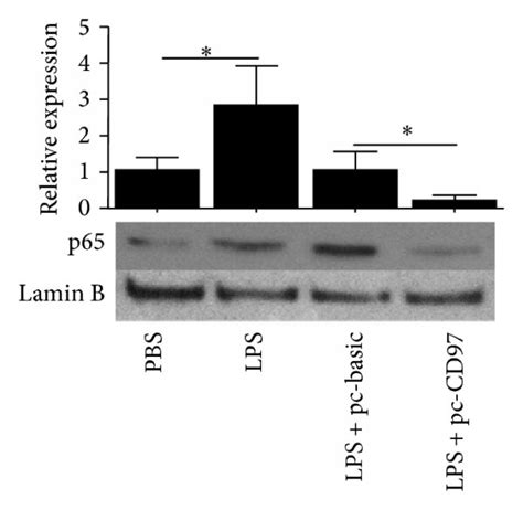 Regulation Of Lps Induced Nf κb Activation By Cd97 In Macrophages A