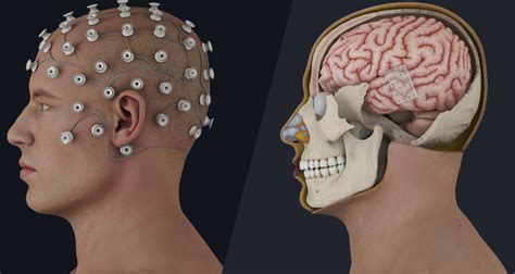 brain computer interface brain computer interfaces a