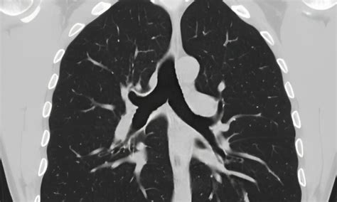 The Ct Scan Cost In Bangalore Kiran Lab