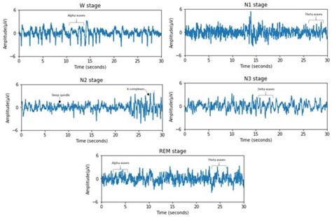 Machine Learning Based Approaches For Sleep Stage Classification Utilising A Combination Of