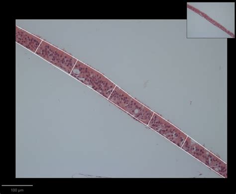 Error On Qupath Scrip For Thickness Epithelium Measurement Image Analysis Imagesc Forum
