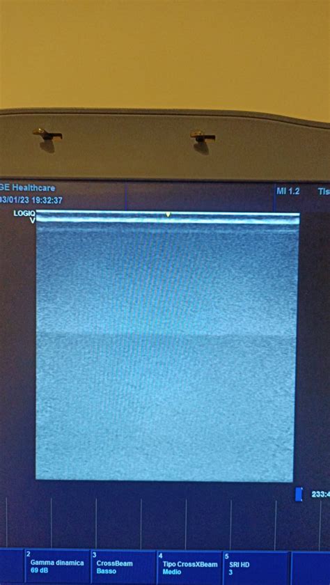 Ultrasound Used On ArcaMed Used Electromedical Machines