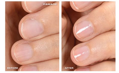 Zoyanakedmanicure Beforeafter