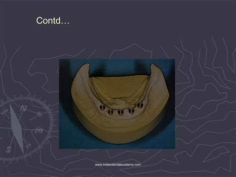 Classification And Impression Techniques Of Implantsprosthodontic