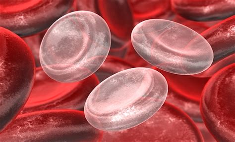 Monoferric Injection Approved For Iron Deficiency Anemia Clinical Advisor