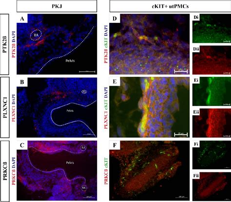 Figure 1 From Identifying Novel Urinary Tract Pacemaker Cell Markers