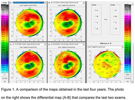 A Comparison Of The Maps Obtained In The Last Four Years The Photo On