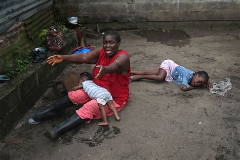 Ebola Victims Bleeding