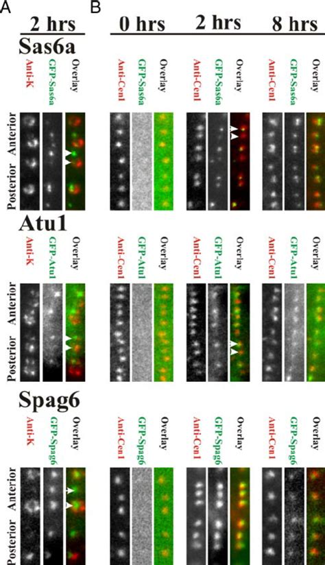 Distinct Classes Of Basal Body Protein Dynamics A Gfp Sas6a And