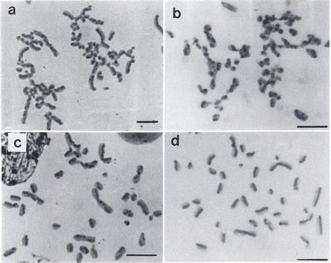 Concurrent Occurrence Of Sces And Chromosome Aberrations Samples Were Download Scientific