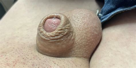 Inverted Tiny Penis 16 Nude Pics Xhamster