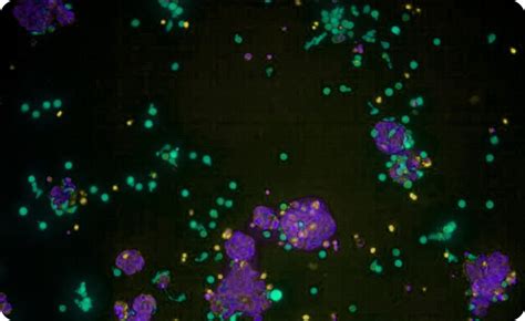 Pdo Monolayer Physiologically Relevant Solutions For Inflammatory
