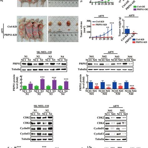 Prps1 Promotes Melanoma Cells Proliferation In Vitro A C The