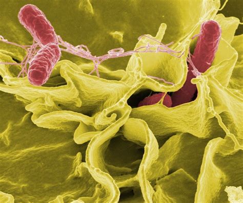 Natural Food Preservative From Bacteria Isolated By Scientists FFOODS Spectrum