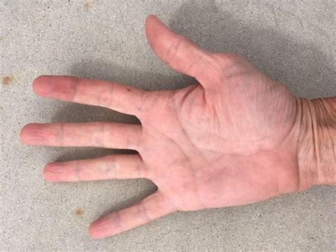 What Palm Reading Palmistry Can Tell You About Your Health And Wellness Cynthia Clark