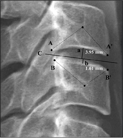 Radiography Distance Calculation At Edyth Herndon Blog
