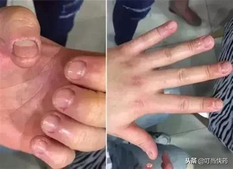 啃指甲、吃手、咬铅笔……孩子小动作背后暗藏心理问题，要警惕 搜狐大视野 搜狐新闻