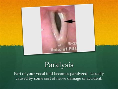 Ppt Vocal Folds Powerpoint Presentation Free Download Id 2460510