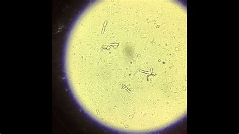 Ever Wonder What Giardia Looks Like Under A Microscope Here Is A Video Of A Giardia Trophozoite