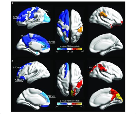 The Surface Distribution Of Cortical Regions Showing Significant