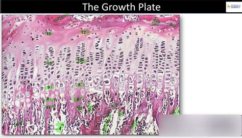 Diagram Of Growth Plate Quizlet