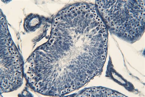 Human Testis Under Microscope View Stock Image Image Of Bladder