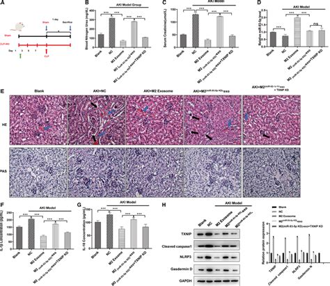 m2‐derived mir‐93‐5p alleviated aki through regulating txnip