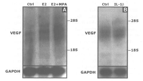 Northern Blotting Analysis Of Vascular Endothelial Growth Factor Vegf