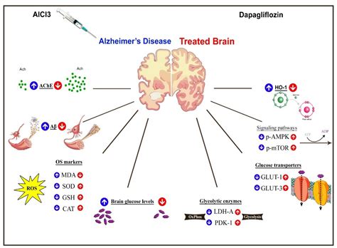 Toward Noninvasive Brain Stimulation In Alzheimers Disease 50 Off