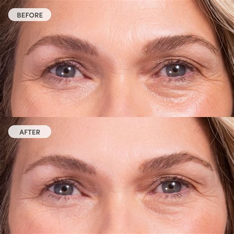 Scar Filler Makeup Uk Saubhaya Makeup